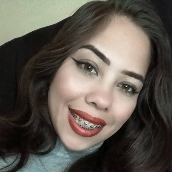 LiveOMG - Live Streams Free. Twitch, Kick, Bigo Live, Periscope, and etc.